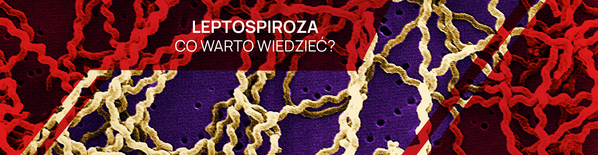 Leptospiroza – kompendium wiedzy o chorobie | TropicalMed